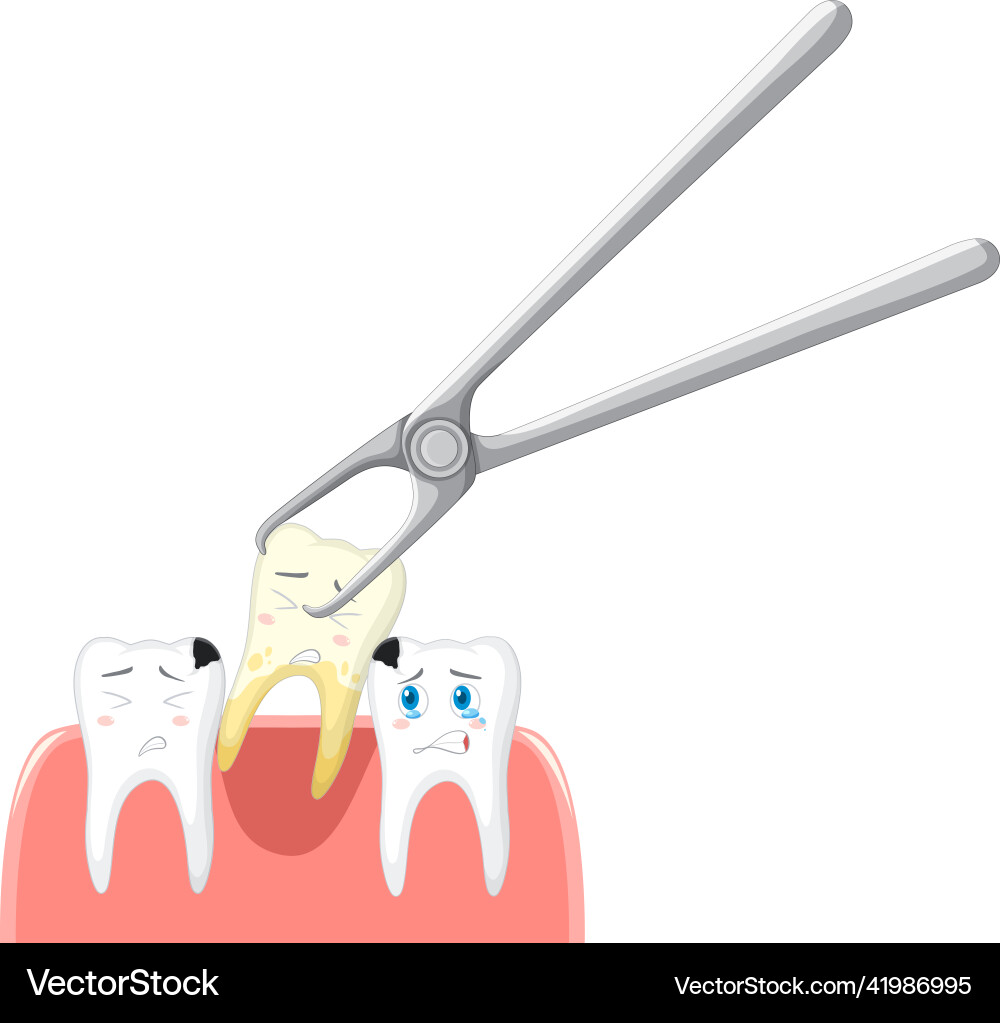 Cartoon teeth extraction on white background Vector Image