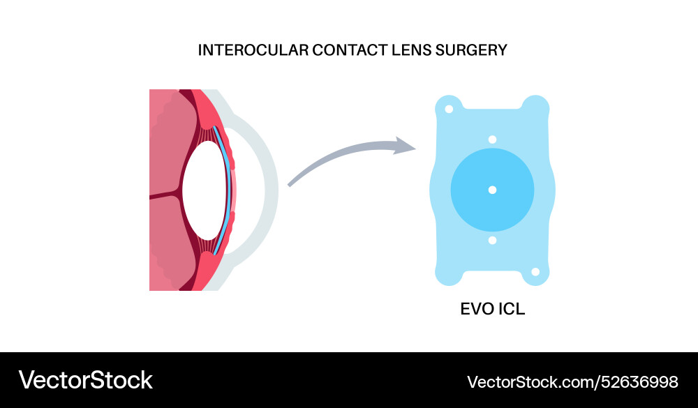 Evo icl poster Royalty Free Vector Image - VectorStock