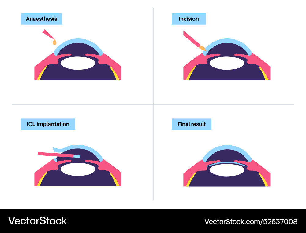 Evo icl poster Royalty Free Vector Image - VectorStock