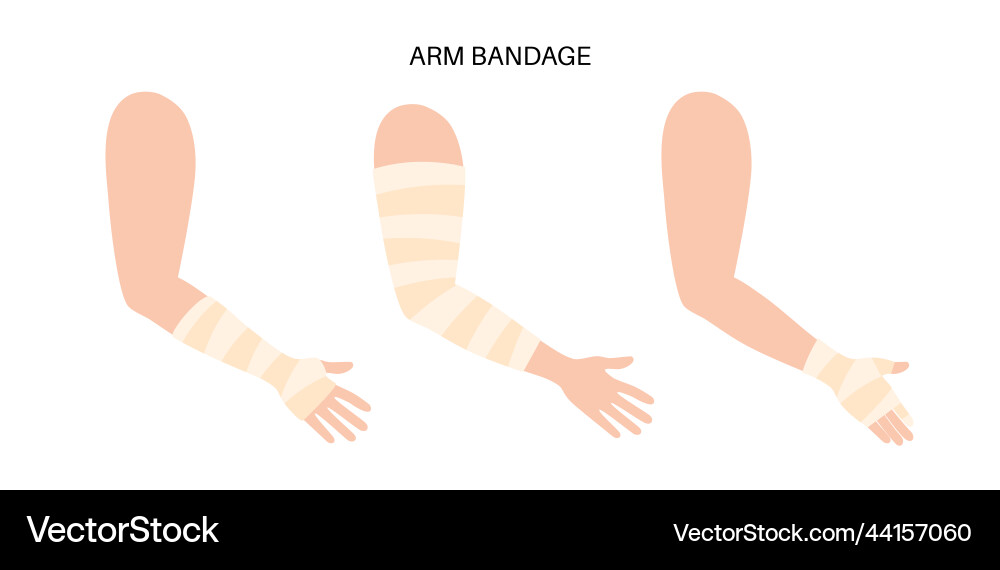 Human arm trauma Royalty Free Vector Image - VectorStock