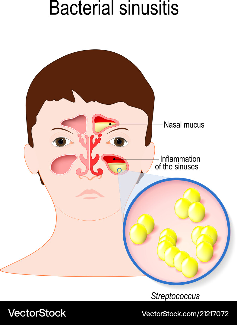 Paranasal Sinus Vector Images (46)