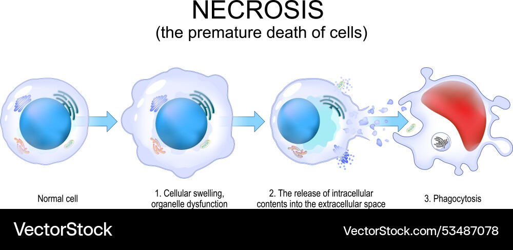 Necrosis uncontrolled cell death Royalty Free Vector Image