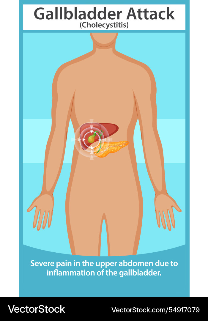 Gallbladder inflammation and pain location Vector Image
