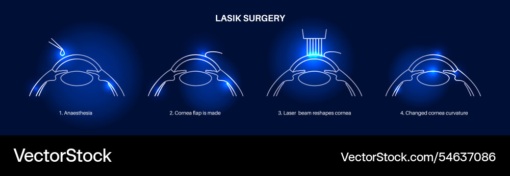 Lasik Vector Images (over 820)