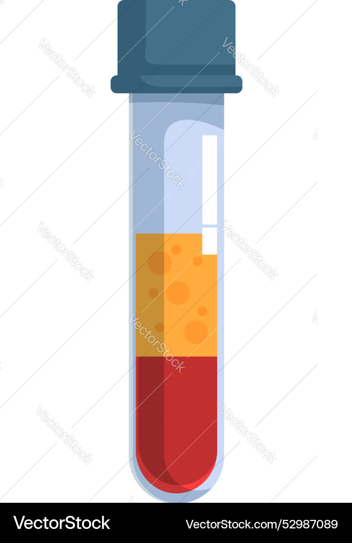 Test tube containing blood sample being analyzed Vector Image
