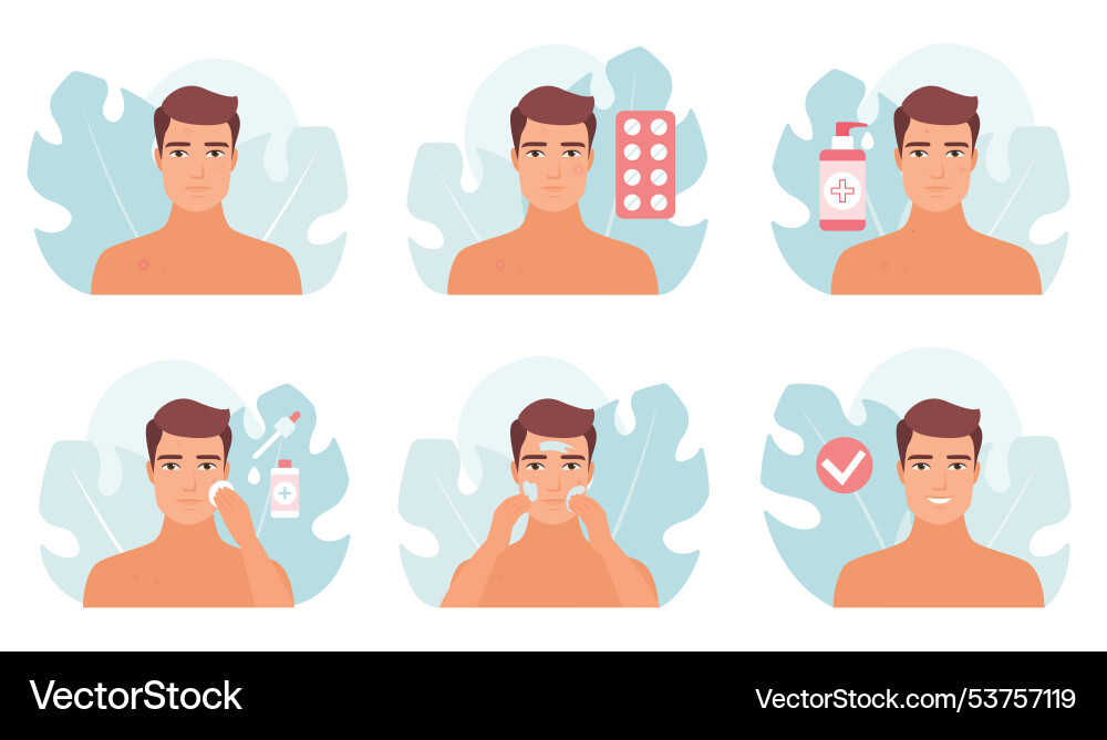 Acne treatment infographic set man cleansing Vector Image