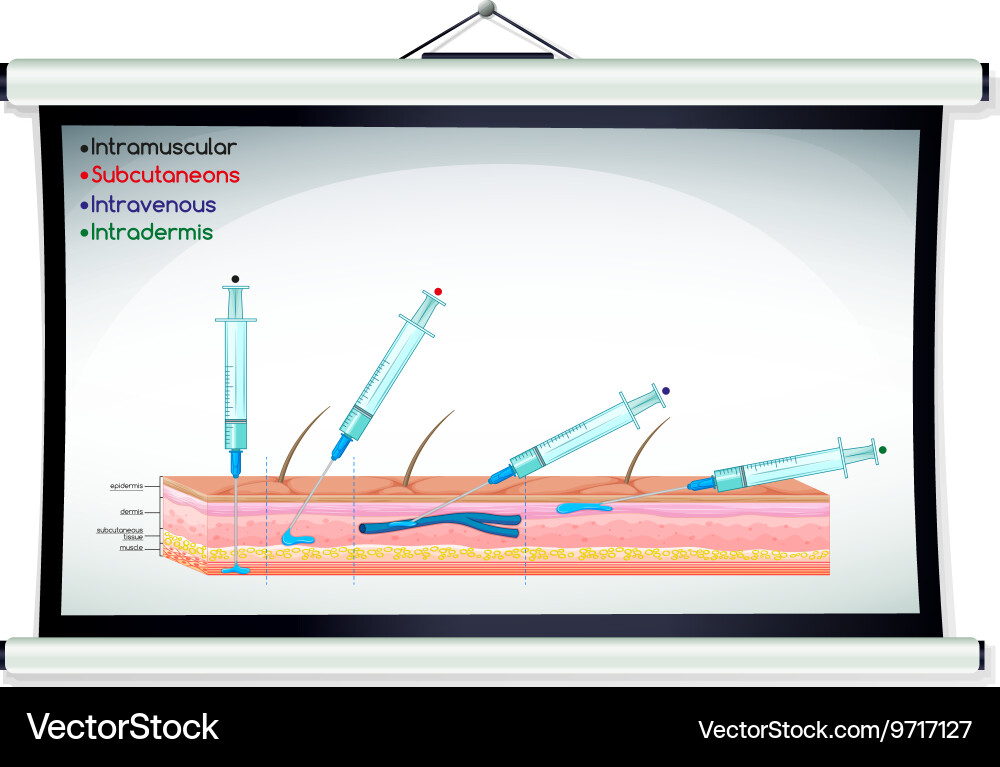 Injection diagram with syringe Royalty Free Vector Image