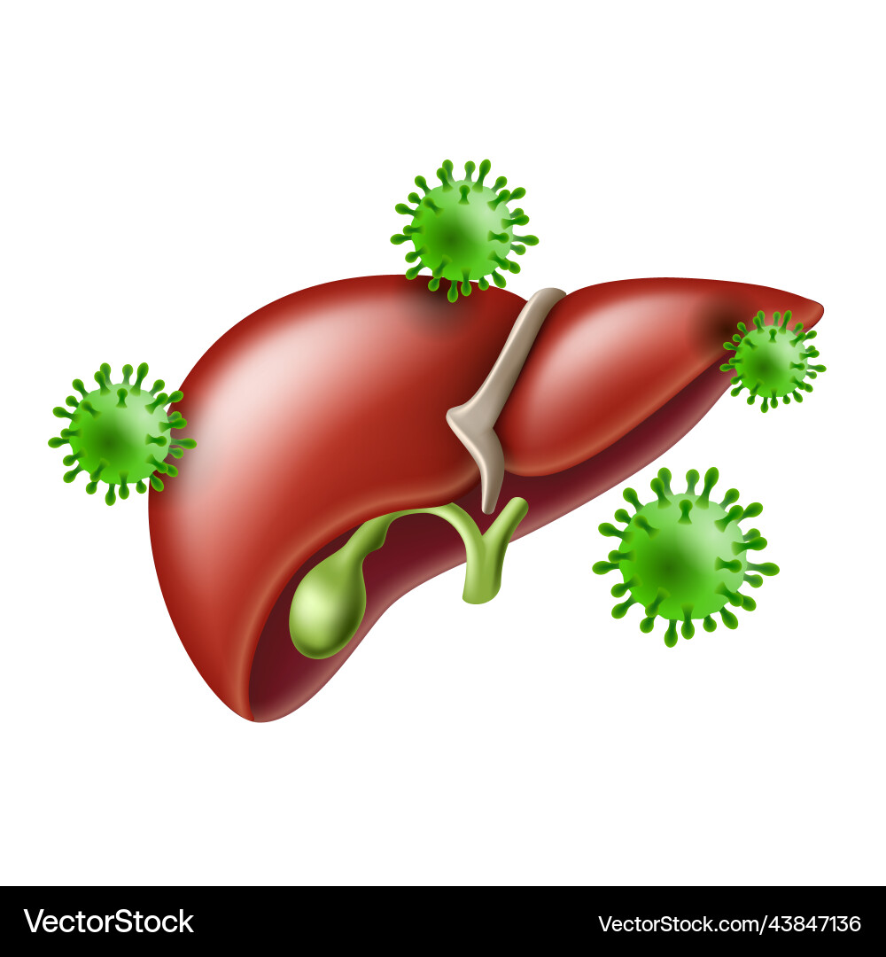 Hepatitis humans liver with viral infection Vector Image