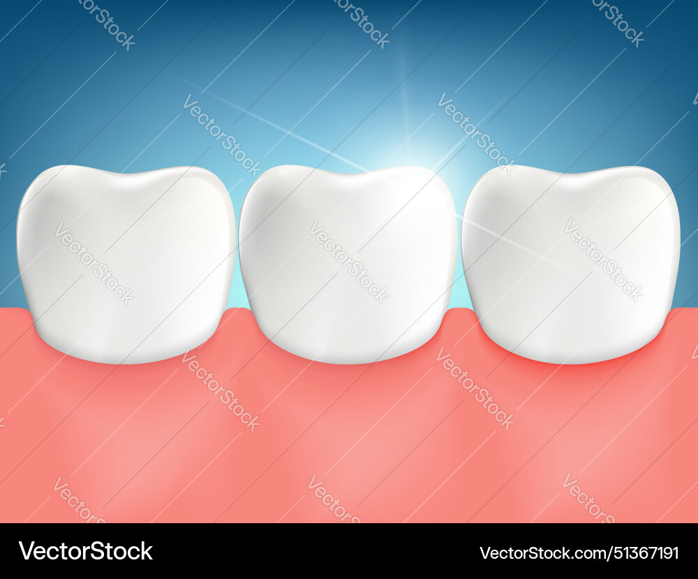 Dental teeth whitening tooth veneers Royalty Free Vector