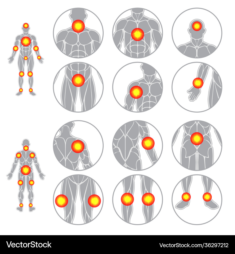 Human Anatomy Pain Points Royalty Free Vector Image