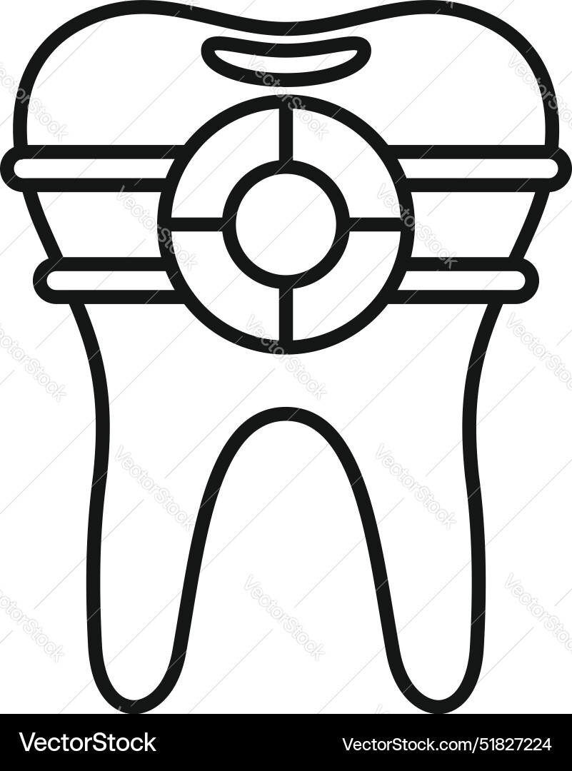 Dental implant being inserted into tooth outline Vector Image
