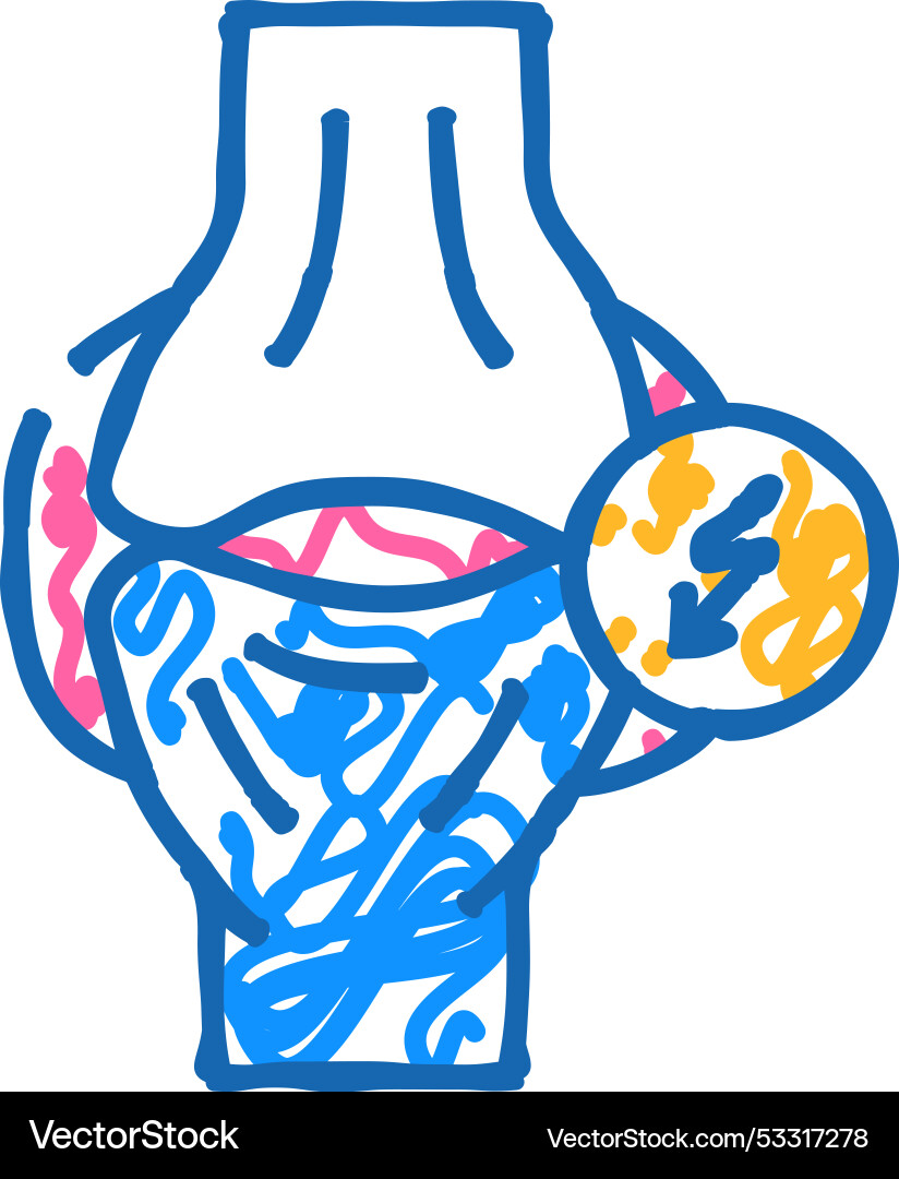 Joint pain icon doodle Royalty Free Vector Image