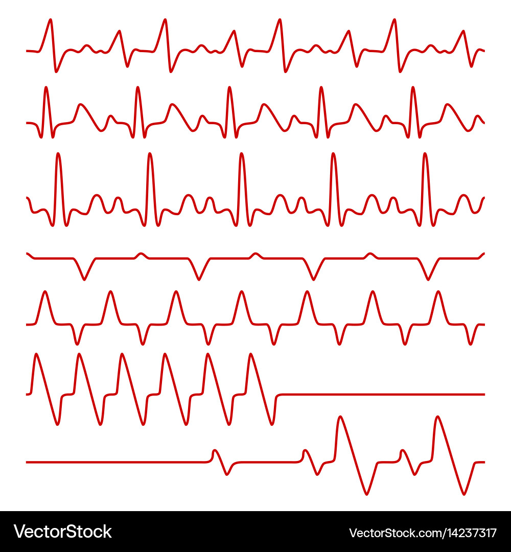 Cardiac Line Charts - Cardiogram Patterns Vector Image