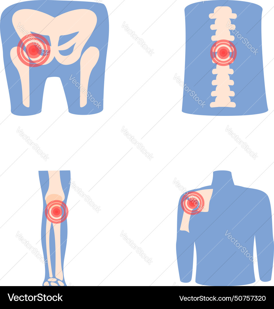Rheumatism icons set cartoon human joint Vector Image Rheumatism icons set cartoon human joint Vector Image