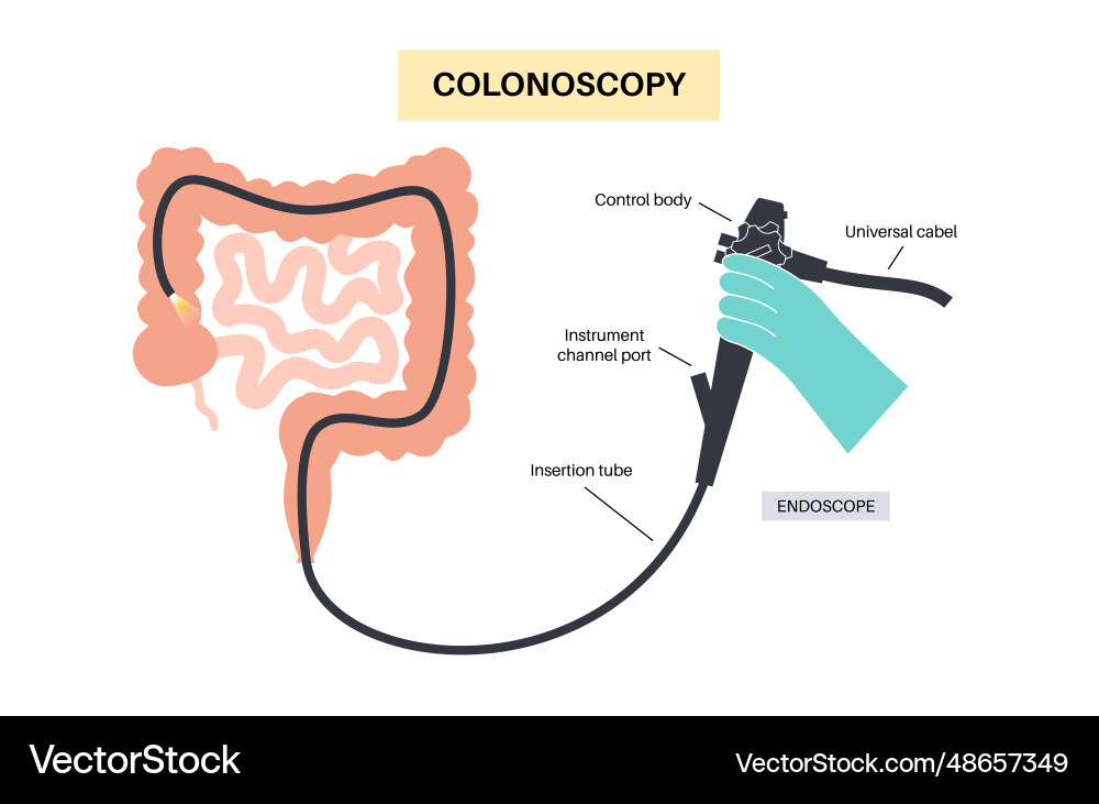 Ibd Vector Images (over 140)