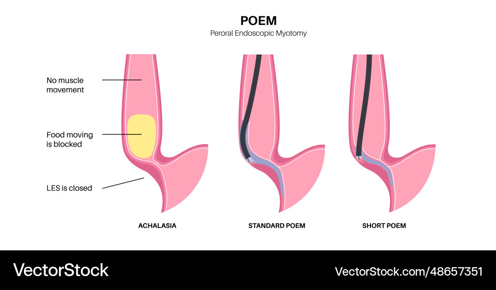 Poem medical poster Royalty Free Vector Image - VectorStock