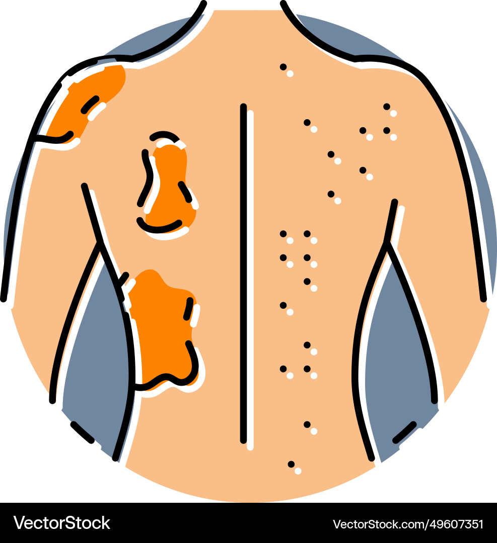 Skin Rash Symptoms Icon Royalty Free Vector Image