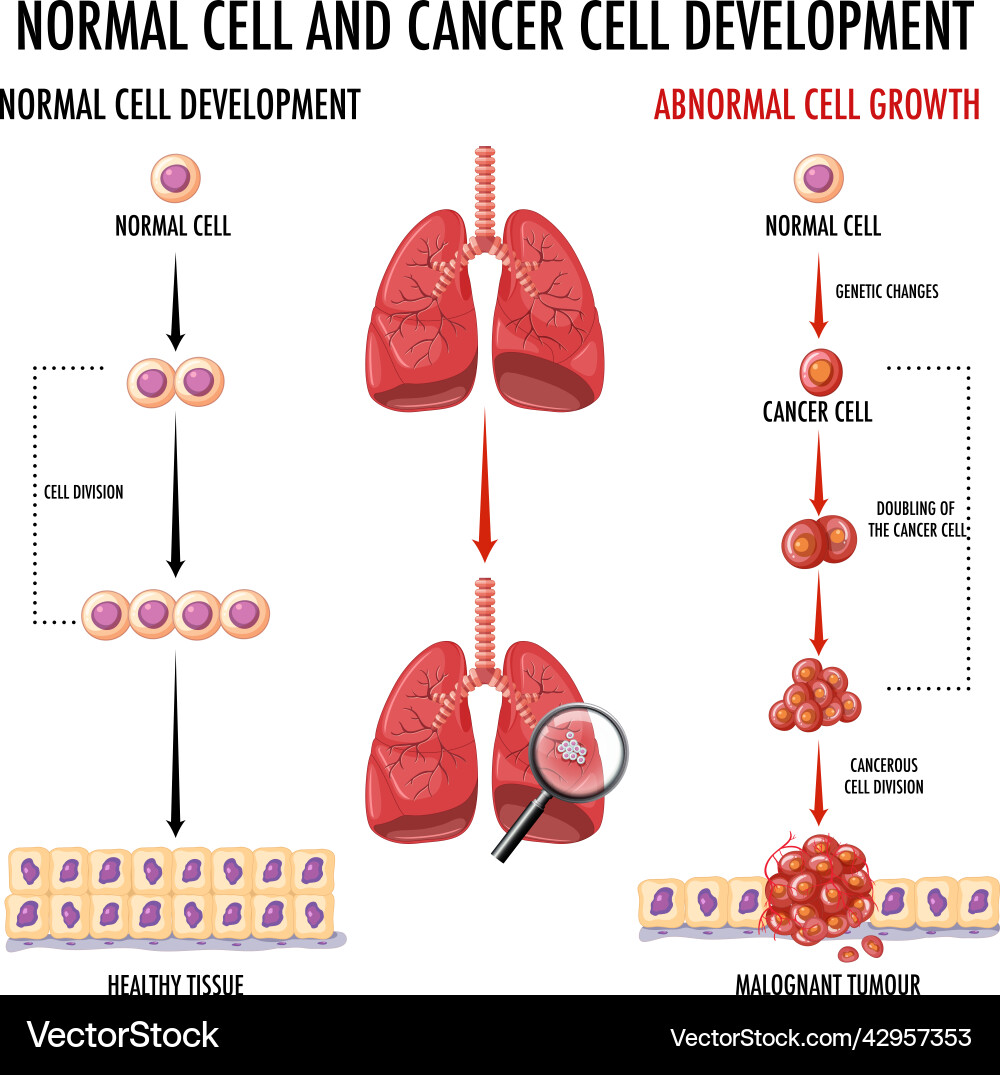 Diagram showing cancer development process Vector Image