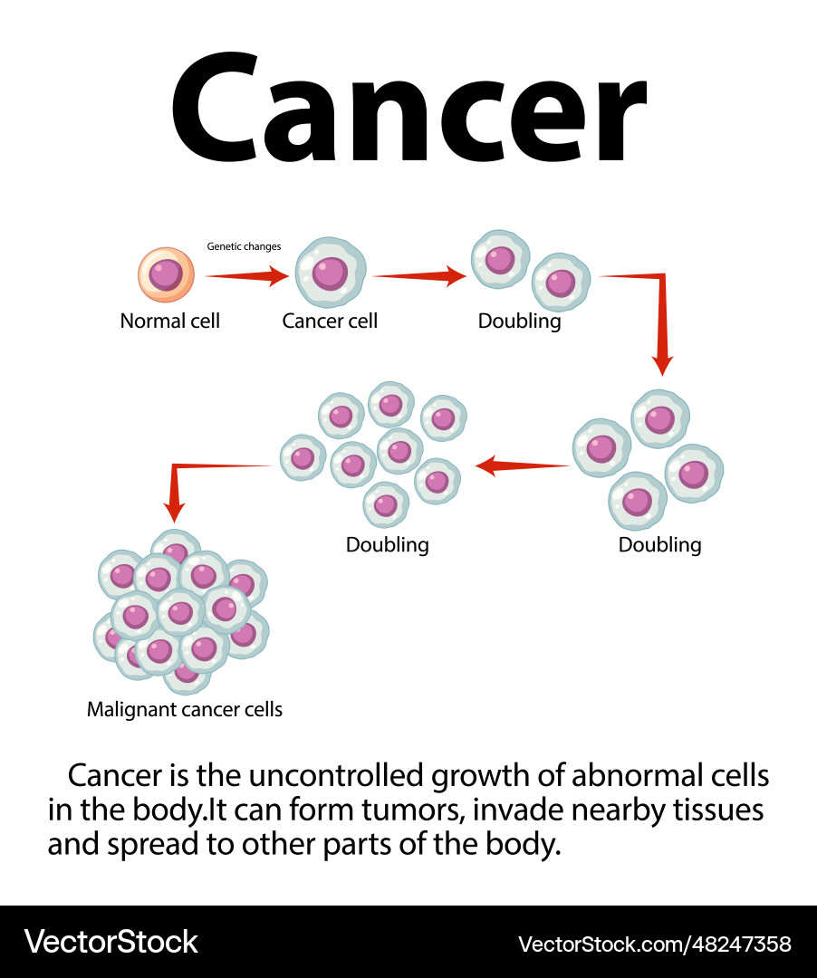 Processing of cancer cells an infographic Vector Image