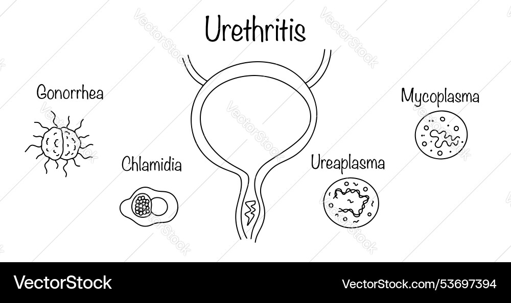 Urethritis Royalty Free Vector Image - VectorStock