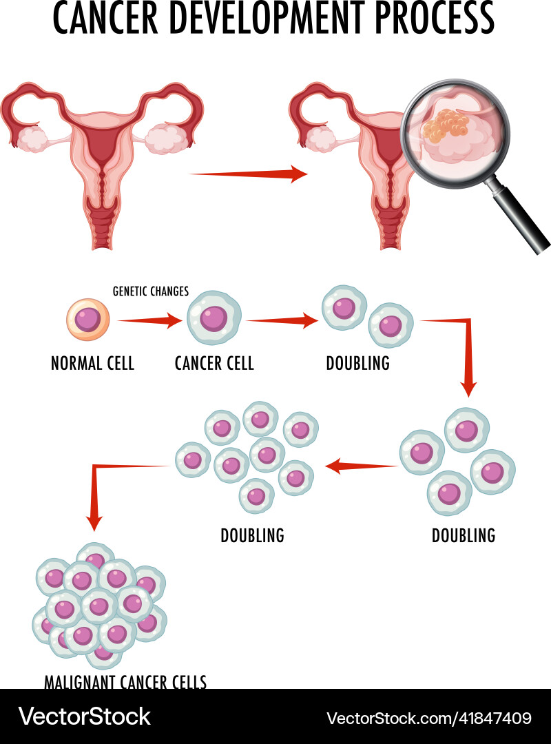 Diagram showing cancer development process Vector Image