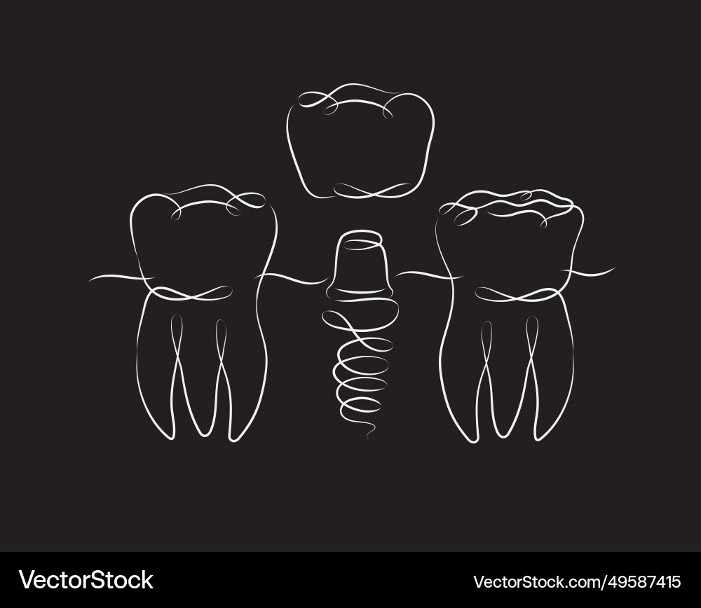 Linear Dental Implant Drawing Royalty Free Vector Image