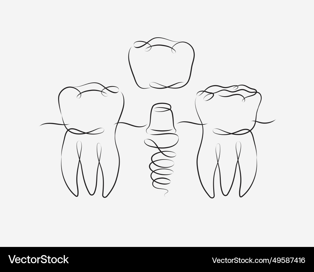 Teeth implant drawing in linear style on white Vector Image