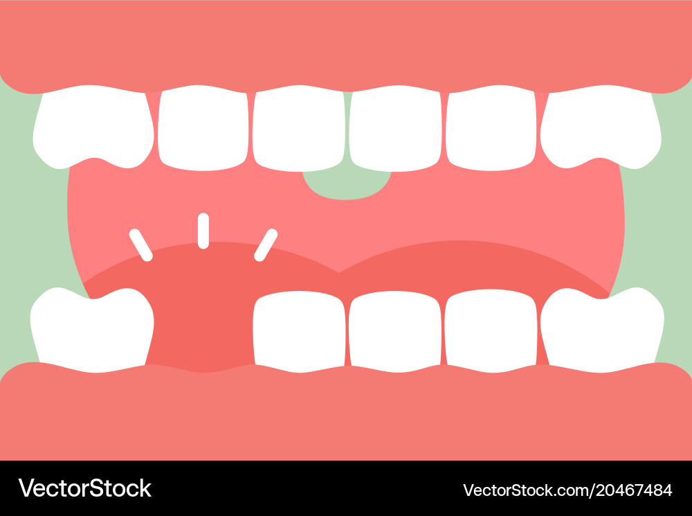 Lose Teeth Vector Images (89)