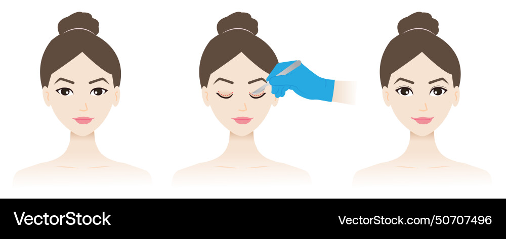 Woman with double eyelid surgery Royalty Free Vector Image