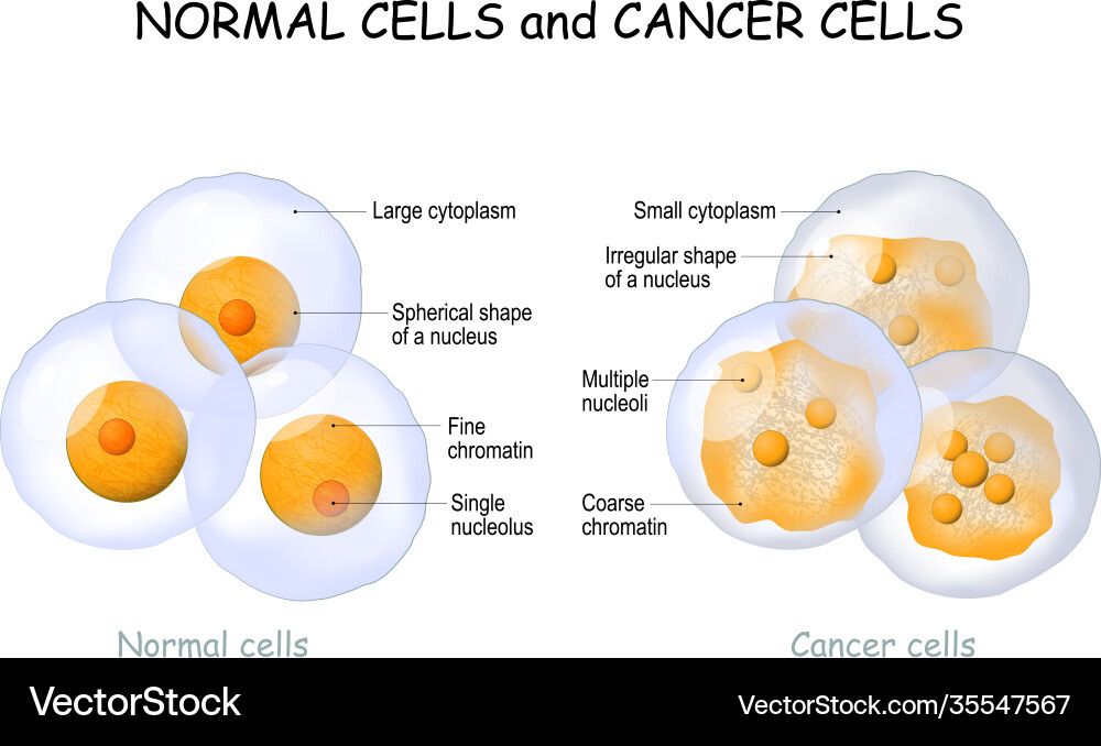 Cancer cells and normal comparison Royalty Free Vector Image