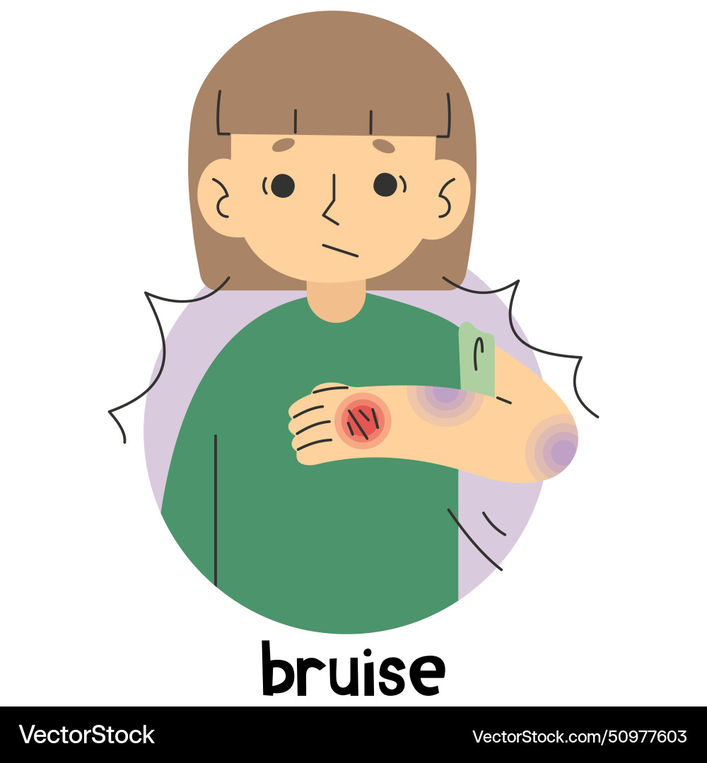 Bruise 7 Royalty Free Vector Image - VectorStock