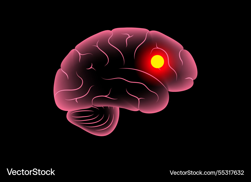 Brain cancer poster Royalty Free Vector Image - VectorStock