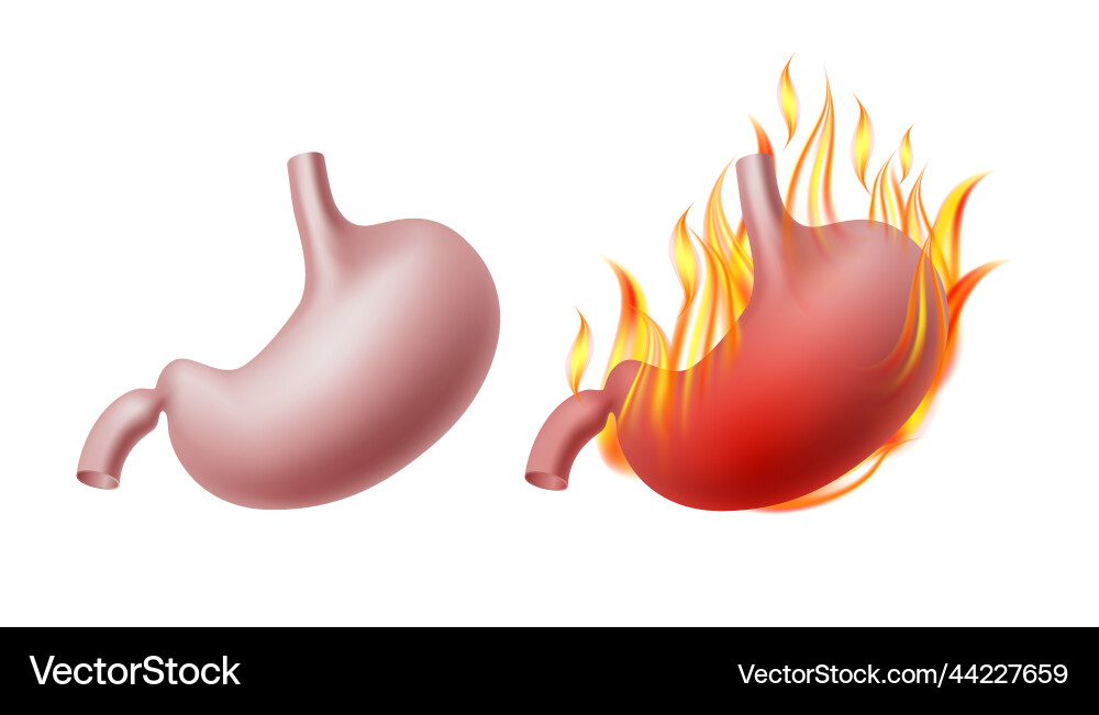 Burning Stomach - Digestive Fire Royalty Free Vector Image