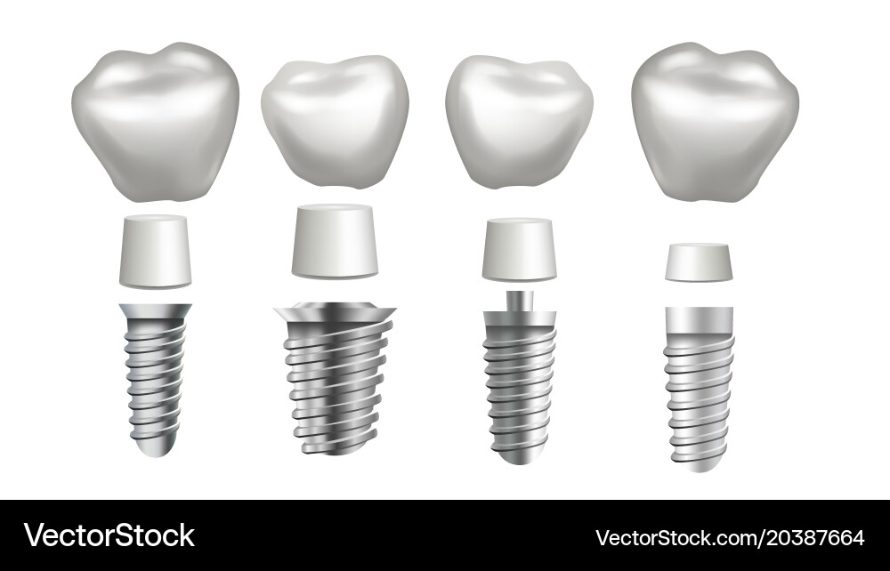 Dental implant set tooth Royalty Free Vector Image