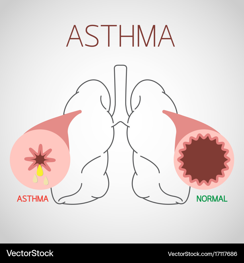 Asthma icon Royalty Free Vector Image - VectorStock