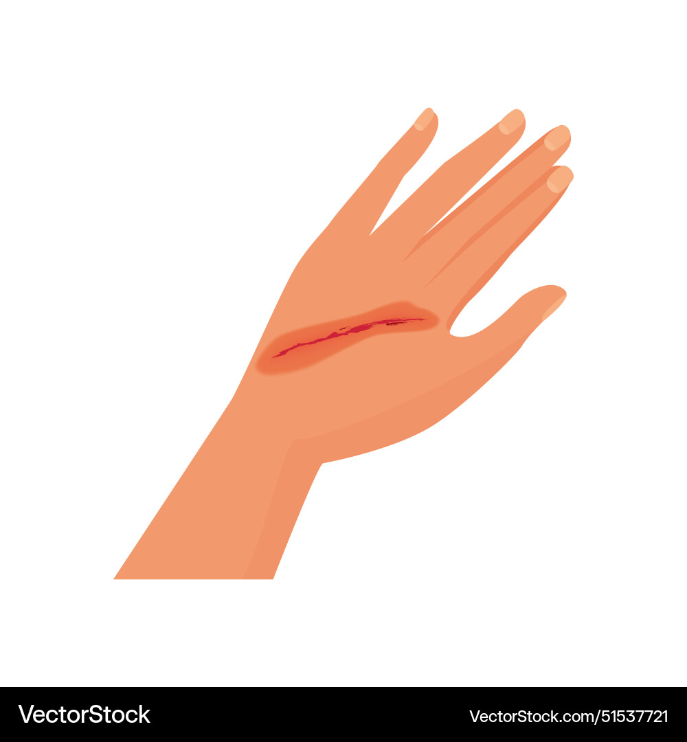 Wound Open Blood Vector Images (90)