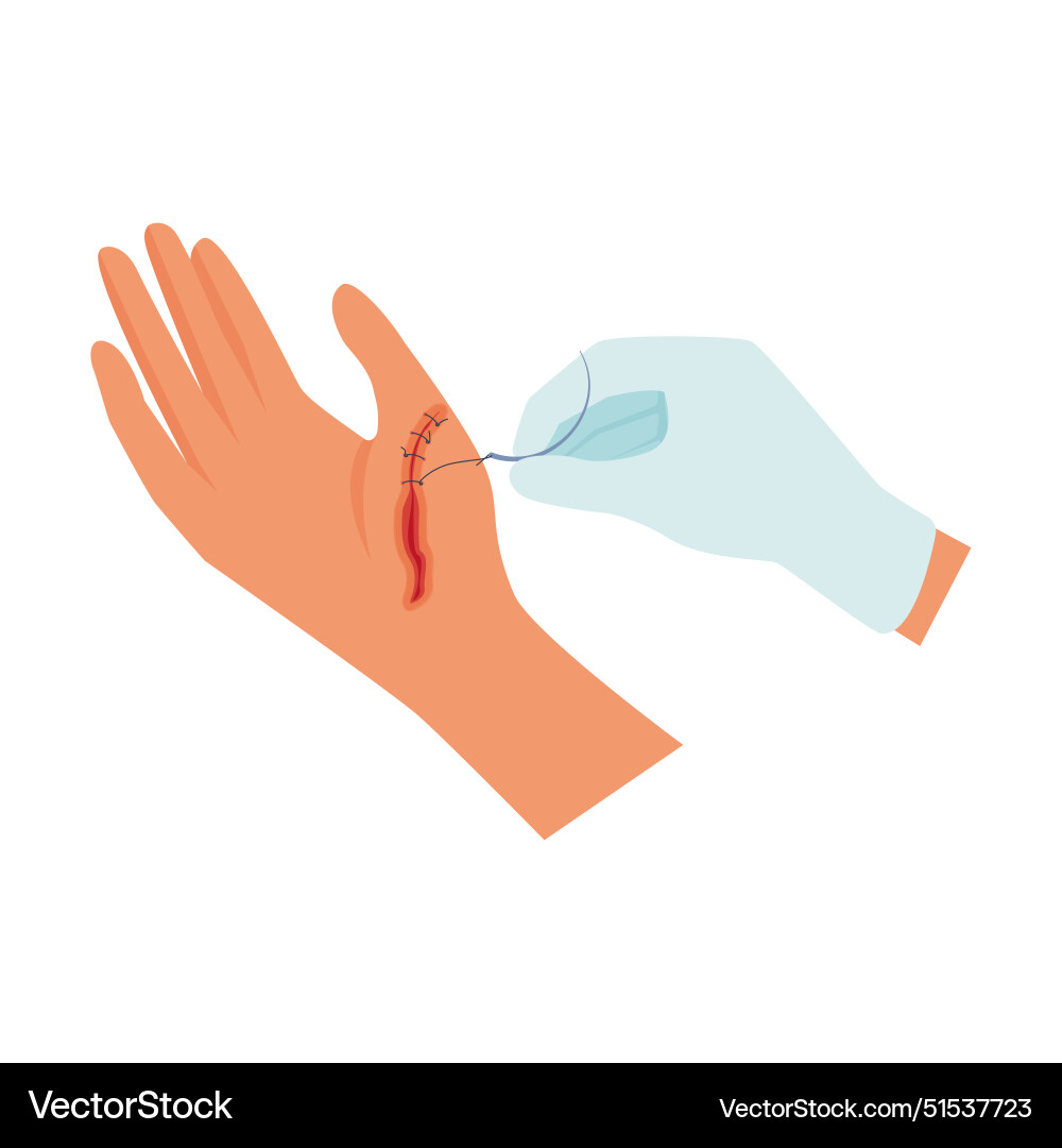 Doctors hand in surgical glove sewing up open Vector Image