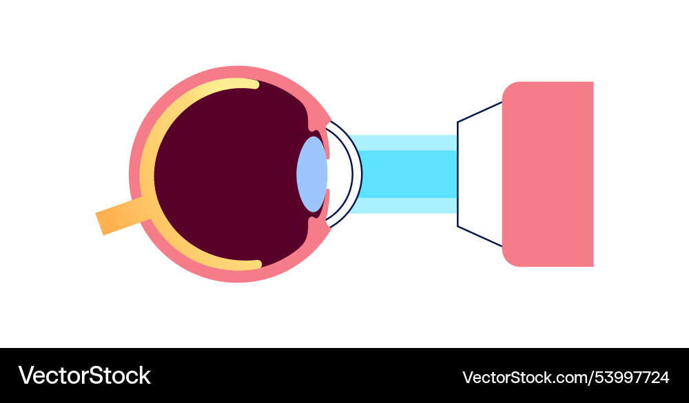 Lasik eye surgery Royalty Free Vector Image - VectorStock