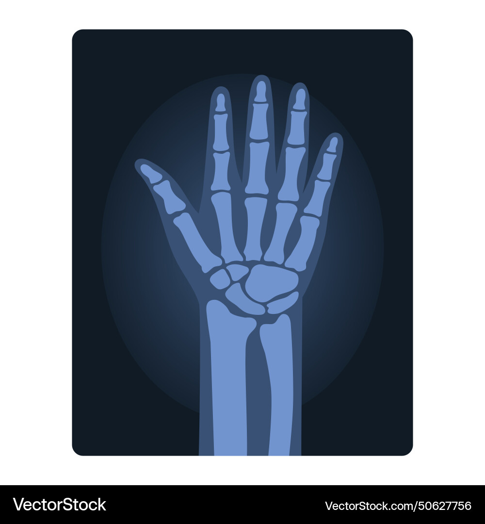 Human Hand X-Ray Radiograph Royalty Free Vector Image