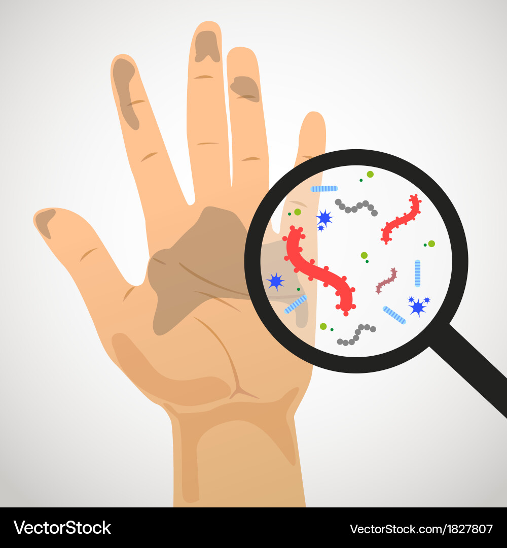 Germy Hand with Magnifying Glass Royalty Free Vector Image