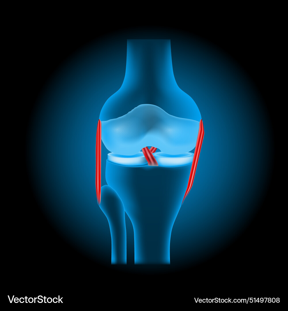 Ligament injuries to the knee joint Royalty Free Vector