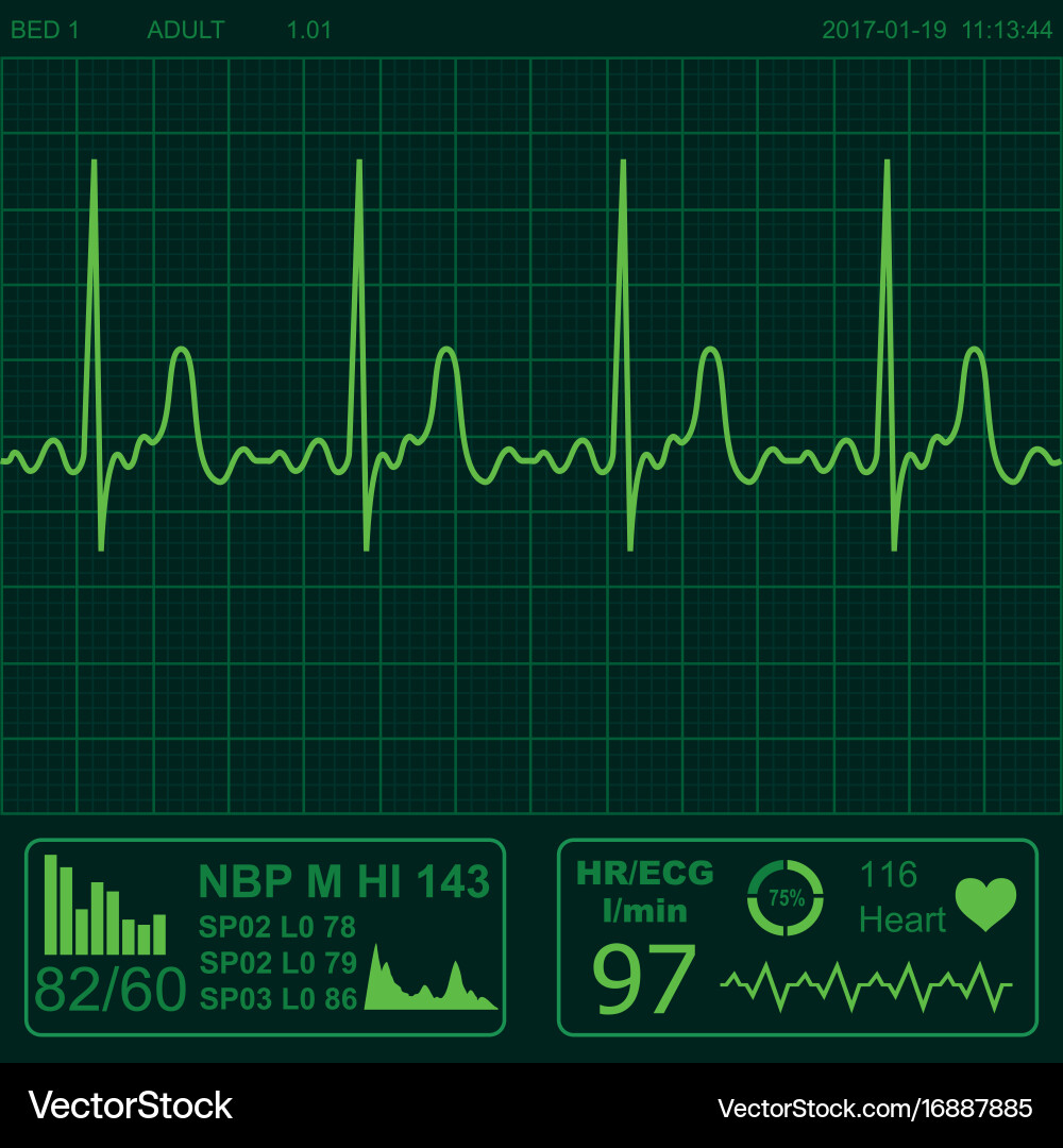 Heart Rhythm Monitor Royalty Free Vector Image