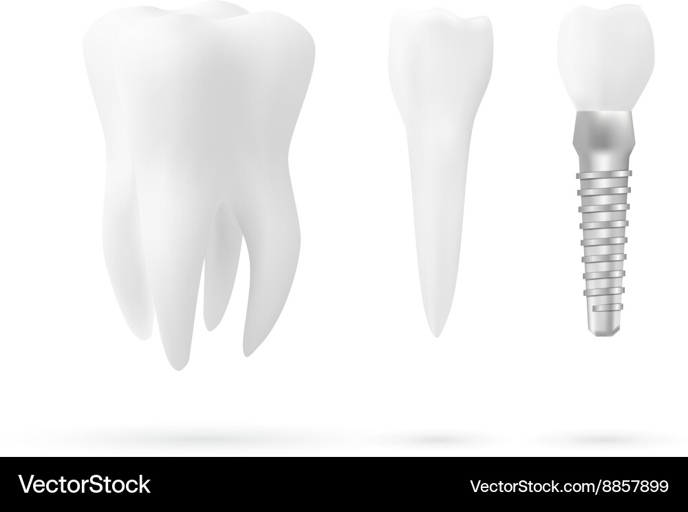 Set of tree tooth Royalty Free Vector Image - VectorStock