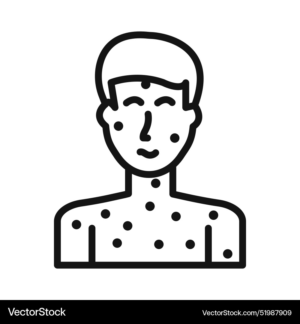 Boy chicken pox icon mark in filled style Vector Image