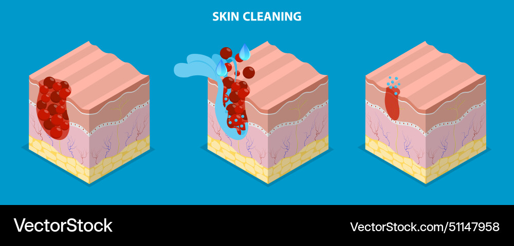 3d isometric flat of skin Royalty Free Vector Image