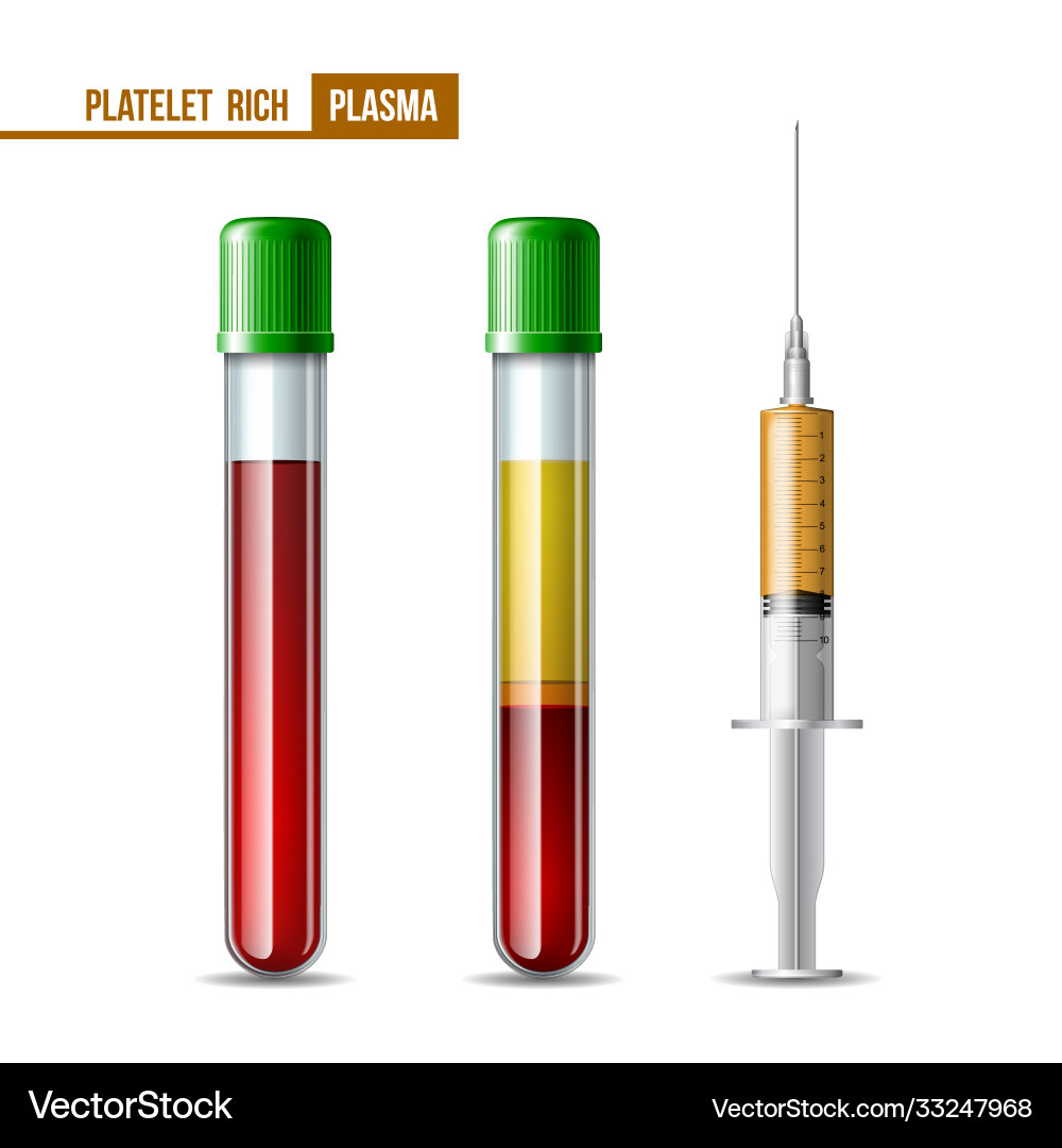 PRP Therapy: Test Tubes & Syringe Royalty Free Vector