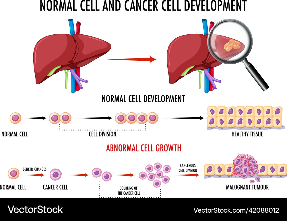 Diagram showing normal and cancer cell Royalty Free Vector