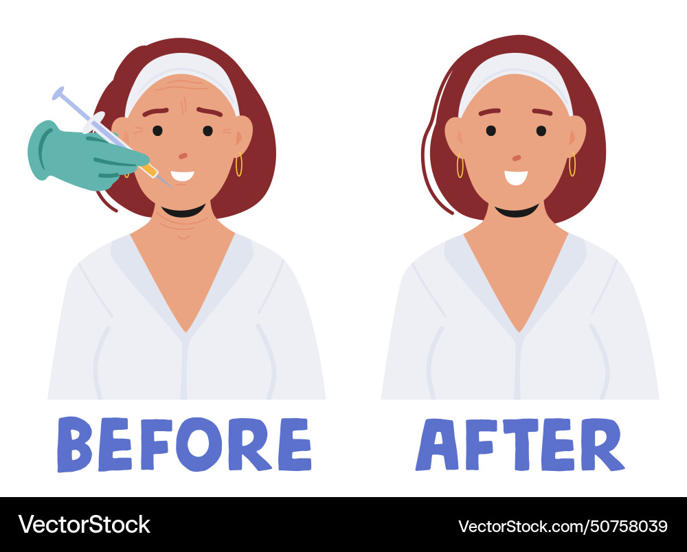 Female face before and after beauty injections Vector Image