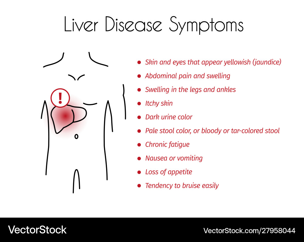 Liver disease symptoms infographic young Vector Image