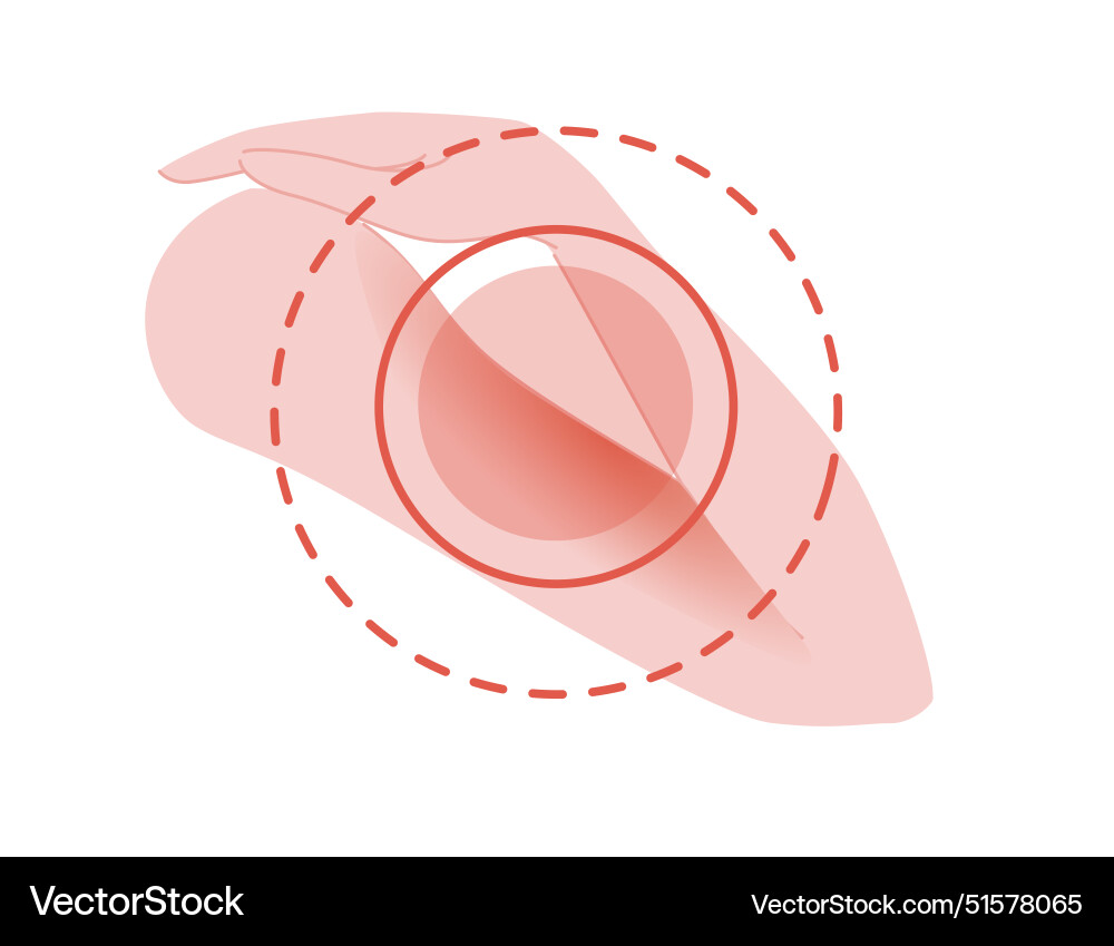 Human elbow pain with red circle flat Royalty Free Vector